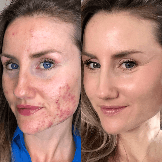 Clearly Basics: Precision Targeted Skincare Products