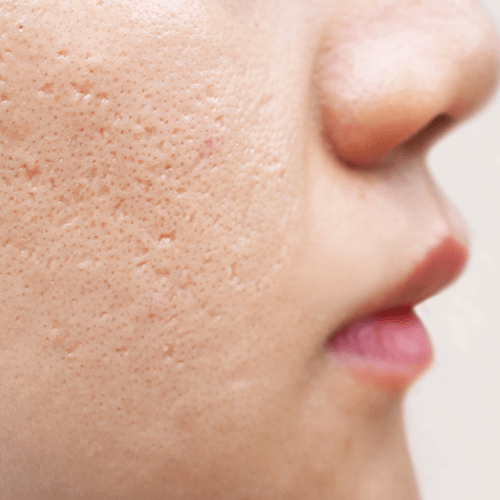 Clearly Basics: Precision Targeted Skincare Products